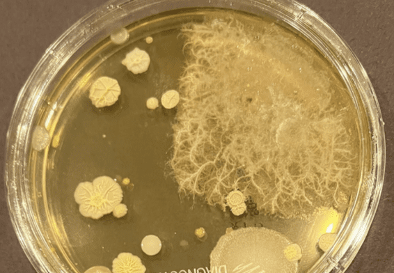 Swab analysis reveals the worrying bacteria growing in hotel beds